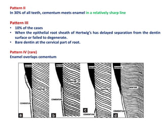 cementum detailed histology and types .pdf