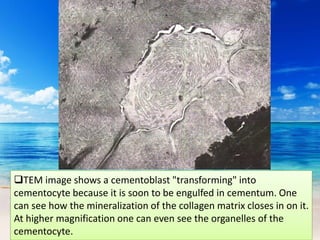 Cementum.pdfffffffffffffffffffffffffffffc | PPT