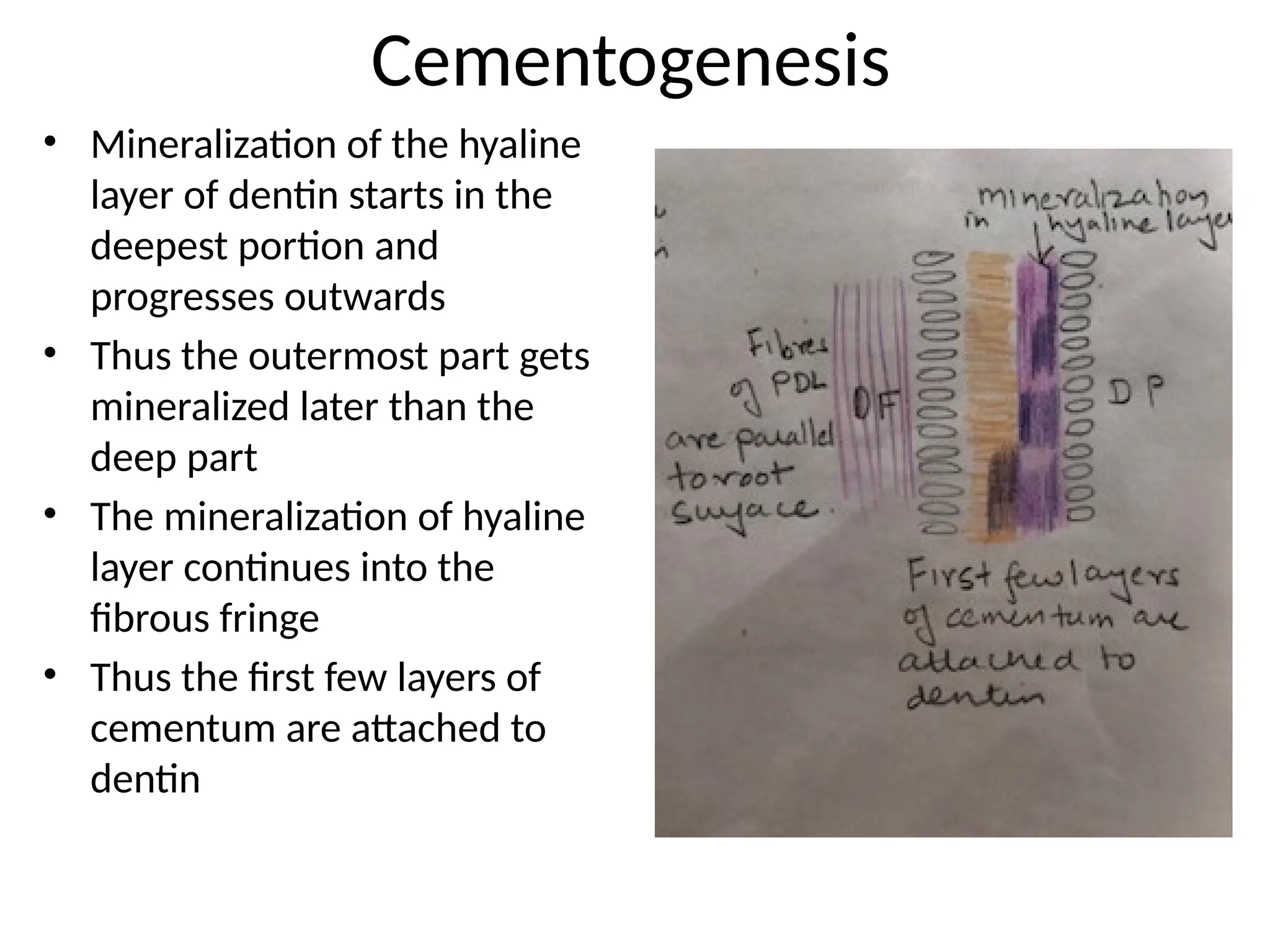 Cementum and its types and abnormalities caused in cementum | PPTX
