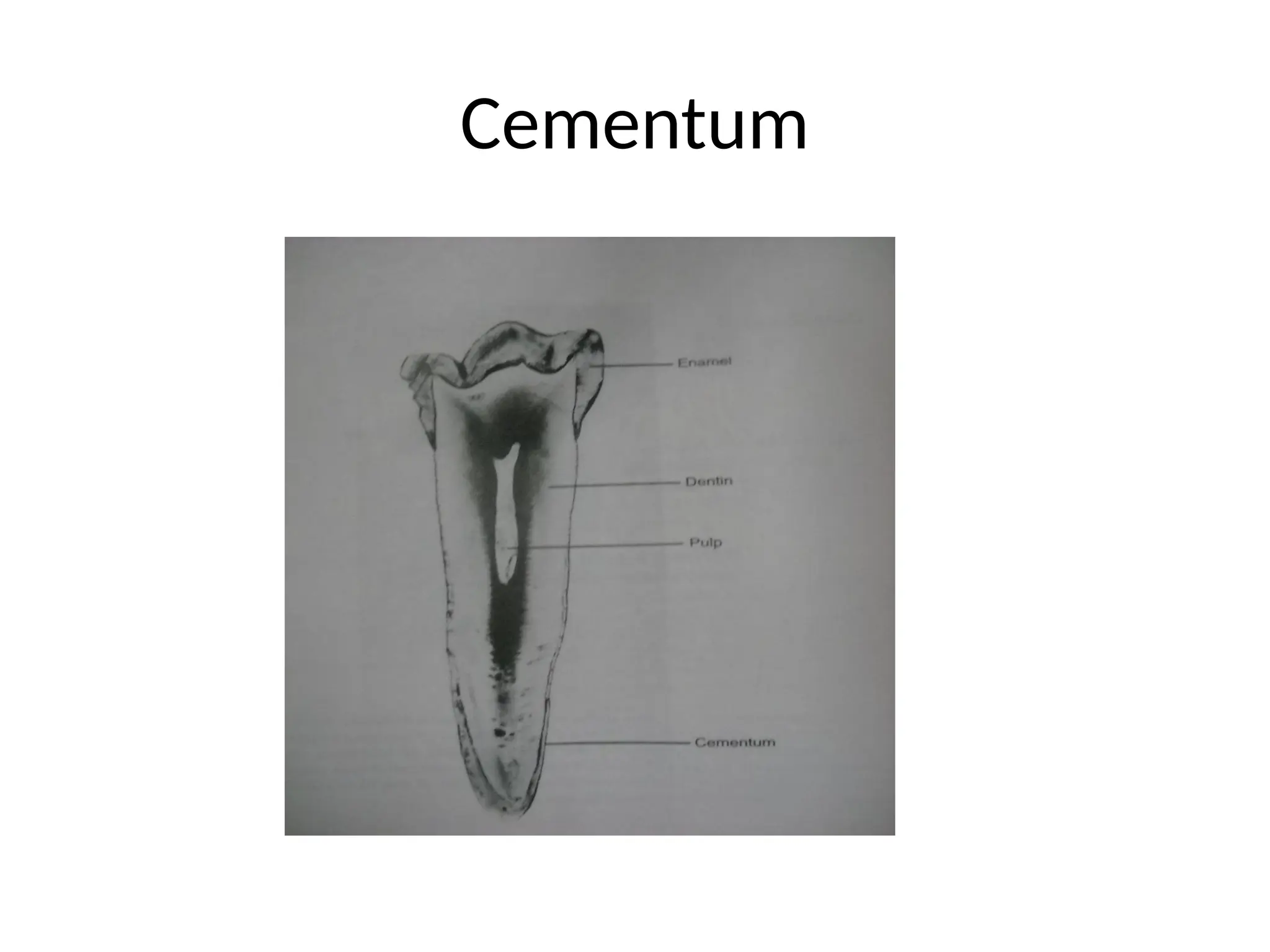 Cementum and its types and abnormalities caused in cementum | PPTX