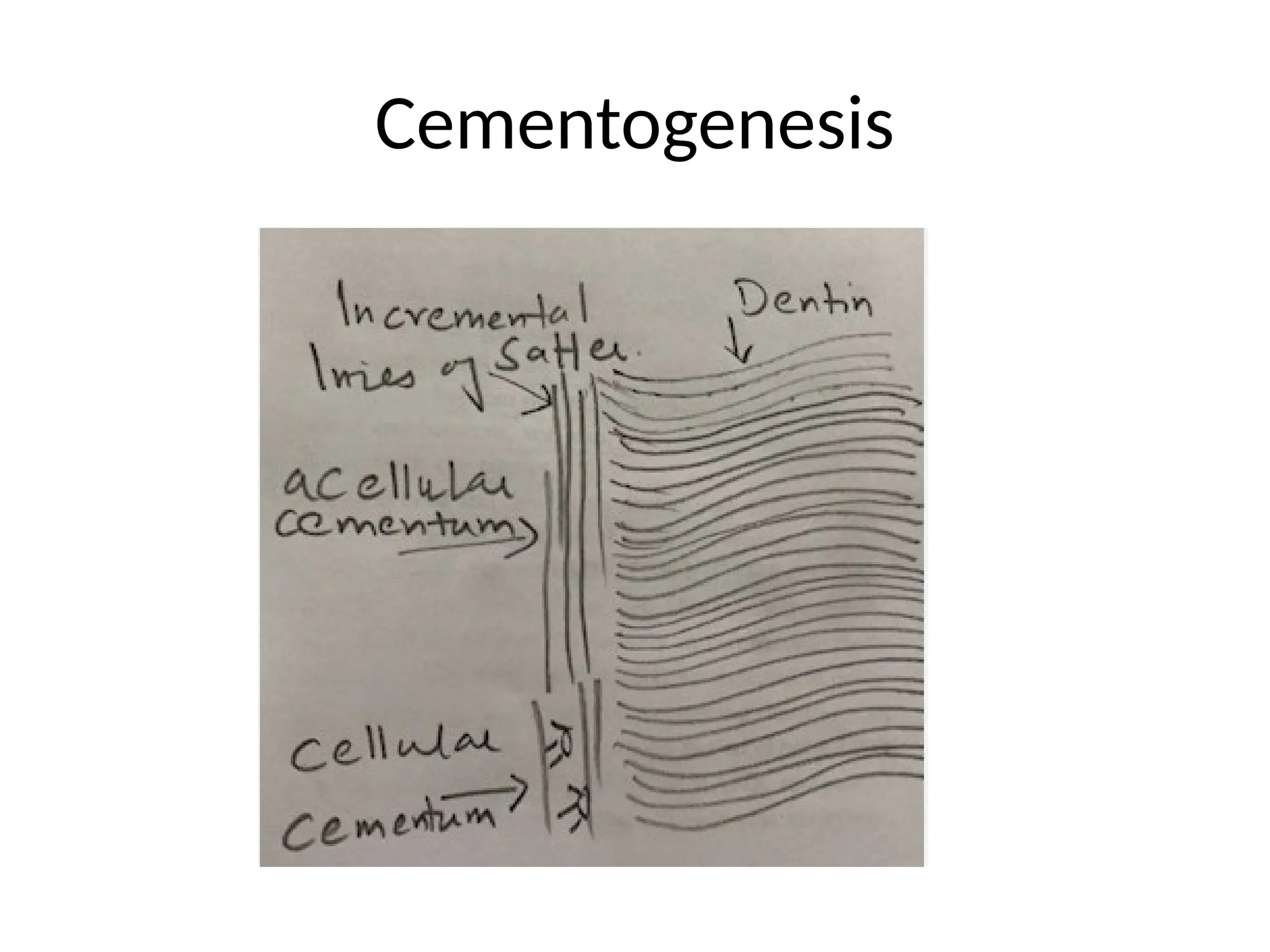 Cementum and its types and abnormalities caused in cementum | PPTX
