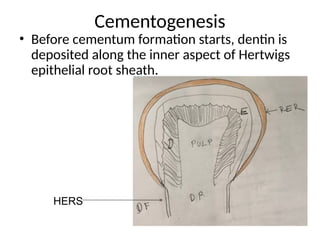 Cementum and its types and abnormalities caused in cementum | PPTX
