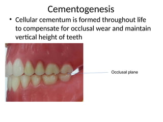 Cementum and its types and abnormalities caused in cementum | PPTX