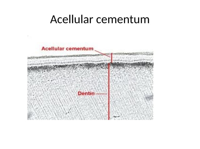 Cementum and its types and abnormalities caused in cementum | PPTX