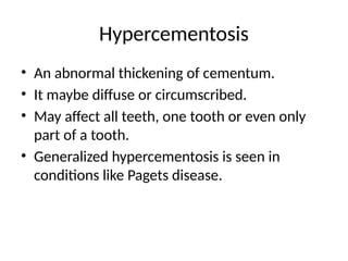Cementum and its types and abnormalities caused in cementum | PPTX