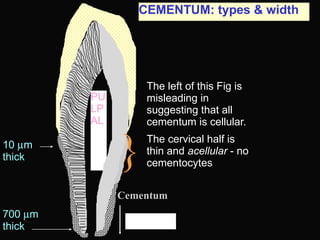Cementum study in periodontics and perio.ppt