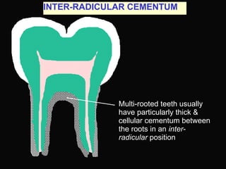 Cementum study in periodontics and perio.ppt