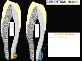 Cementum study in periodontics and perio.ppt
