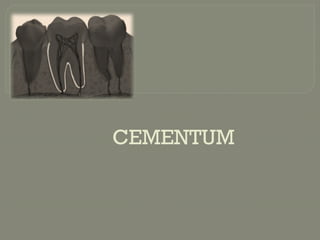 Cementum, a supporting structure of periodontium. | PPTX
