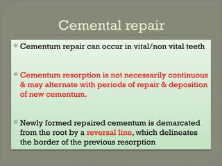 Cementum, a supporting structure of periodontium. | PPT