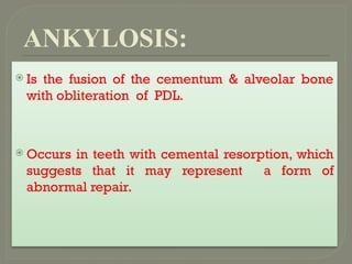 Cementum, a supporting structure of periodontium. | PPTX