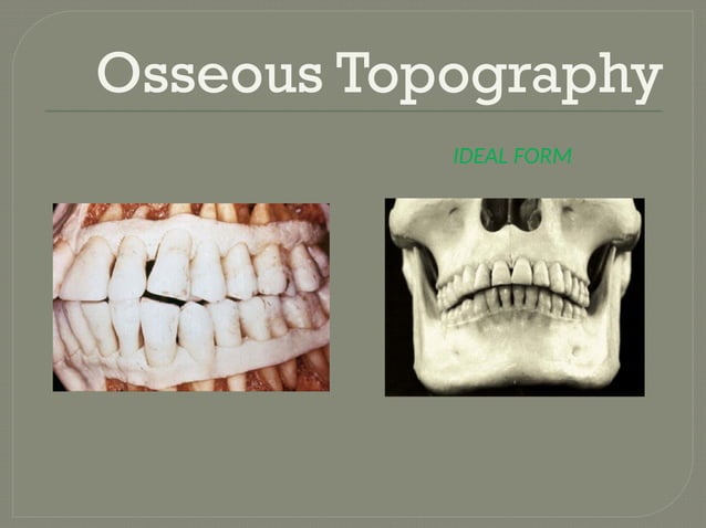 Cementum, a supporting structure of periodontium. | PPT