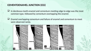 CEMENTUM anatomy and histology in oral anatomy | PPTX
