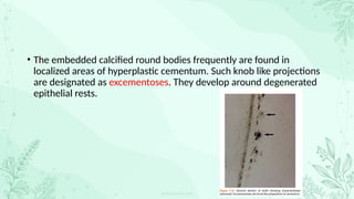 CEMENTUM anatomy and histology in oral anatomy | PPTX