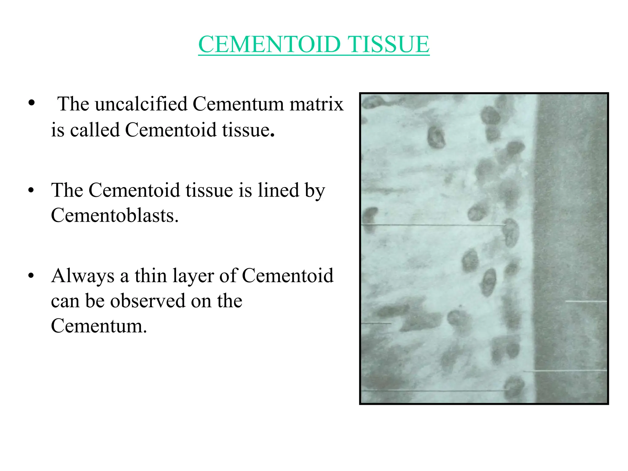Histology, Development of Cementum of Oral Cavity | PPT
