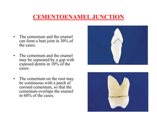 Histology, Development of Cementum of Oral Cavity | PPT