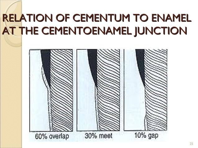 Cementum | PPT