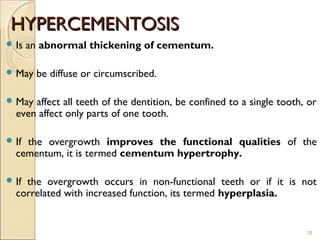 Cementum | PPT