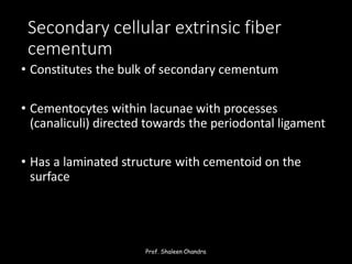Cementum (1) (1).pptx
