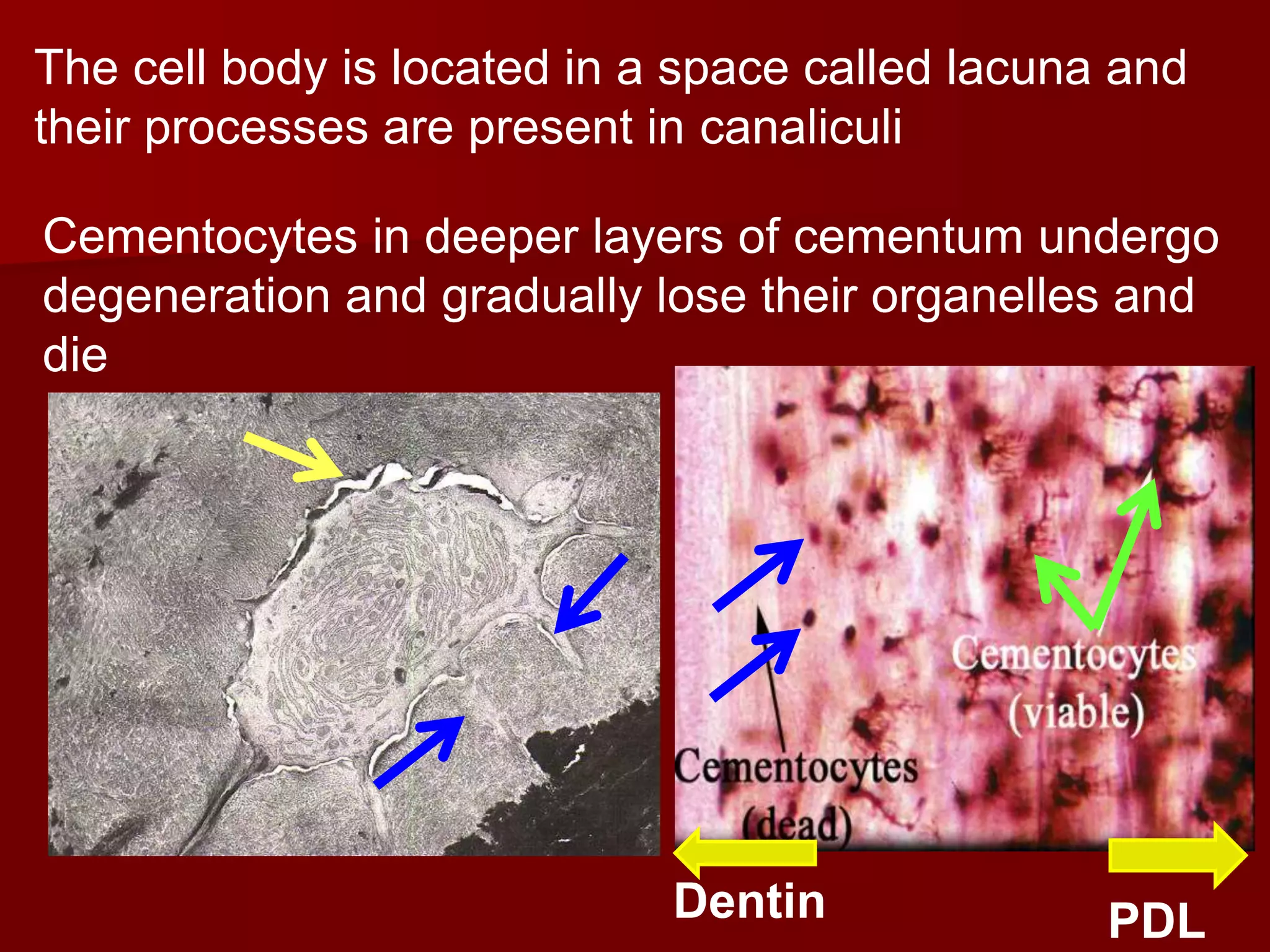 Cementum 2014 | PPTX