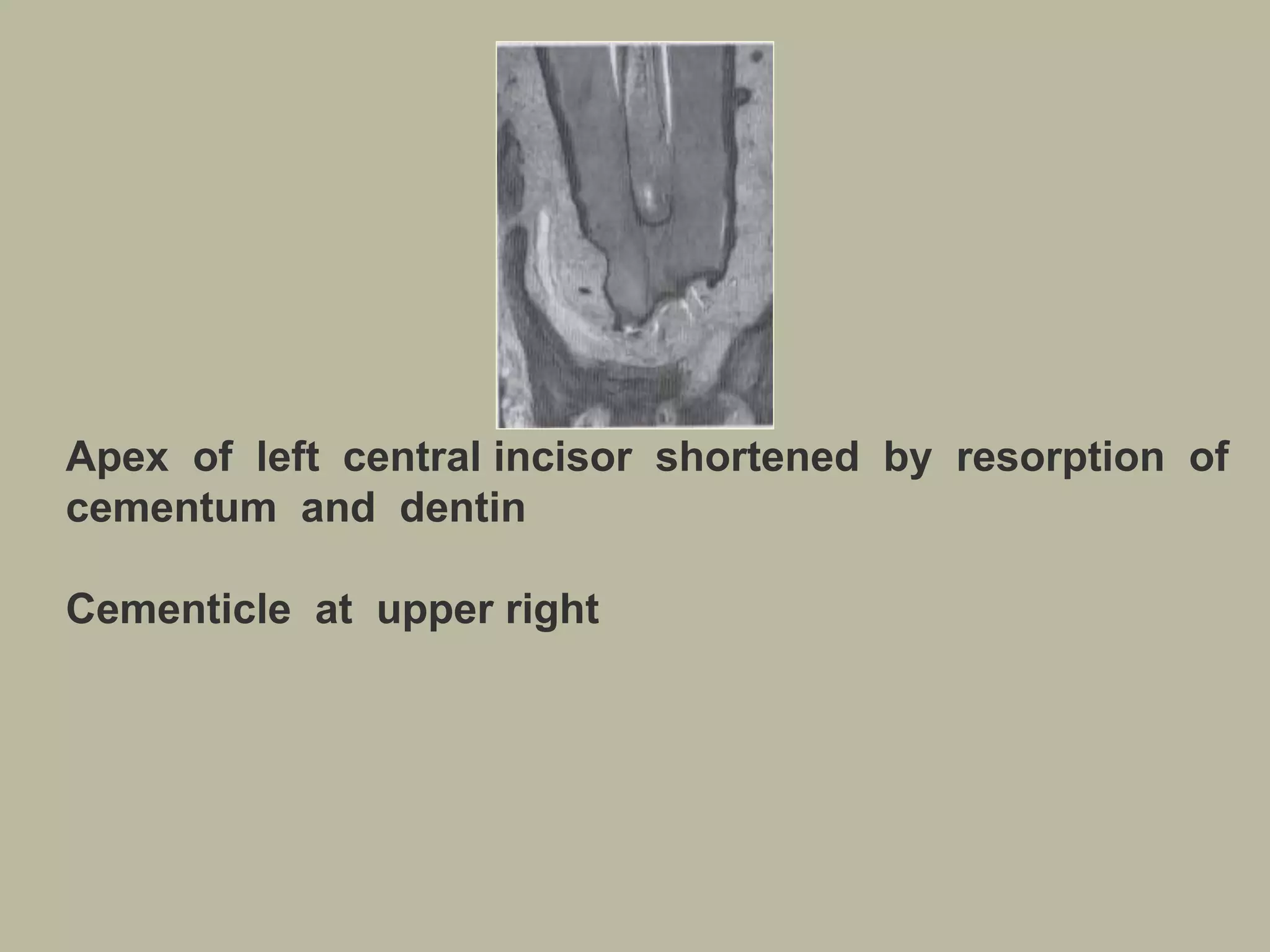 CEMENTUM & AL.BONE.ppt