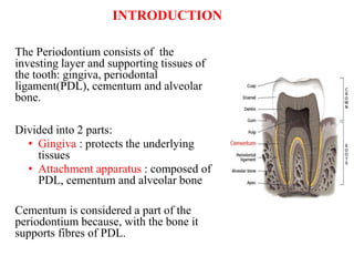 cementum by dr. ishu singla.pptx