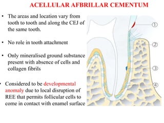 cementum by dr. ishu singla.pptx