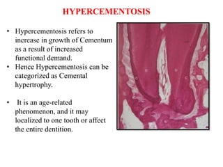 cementum by dr. ishu singla.pptx