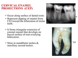 cementum by dr. ishu singla.pptx