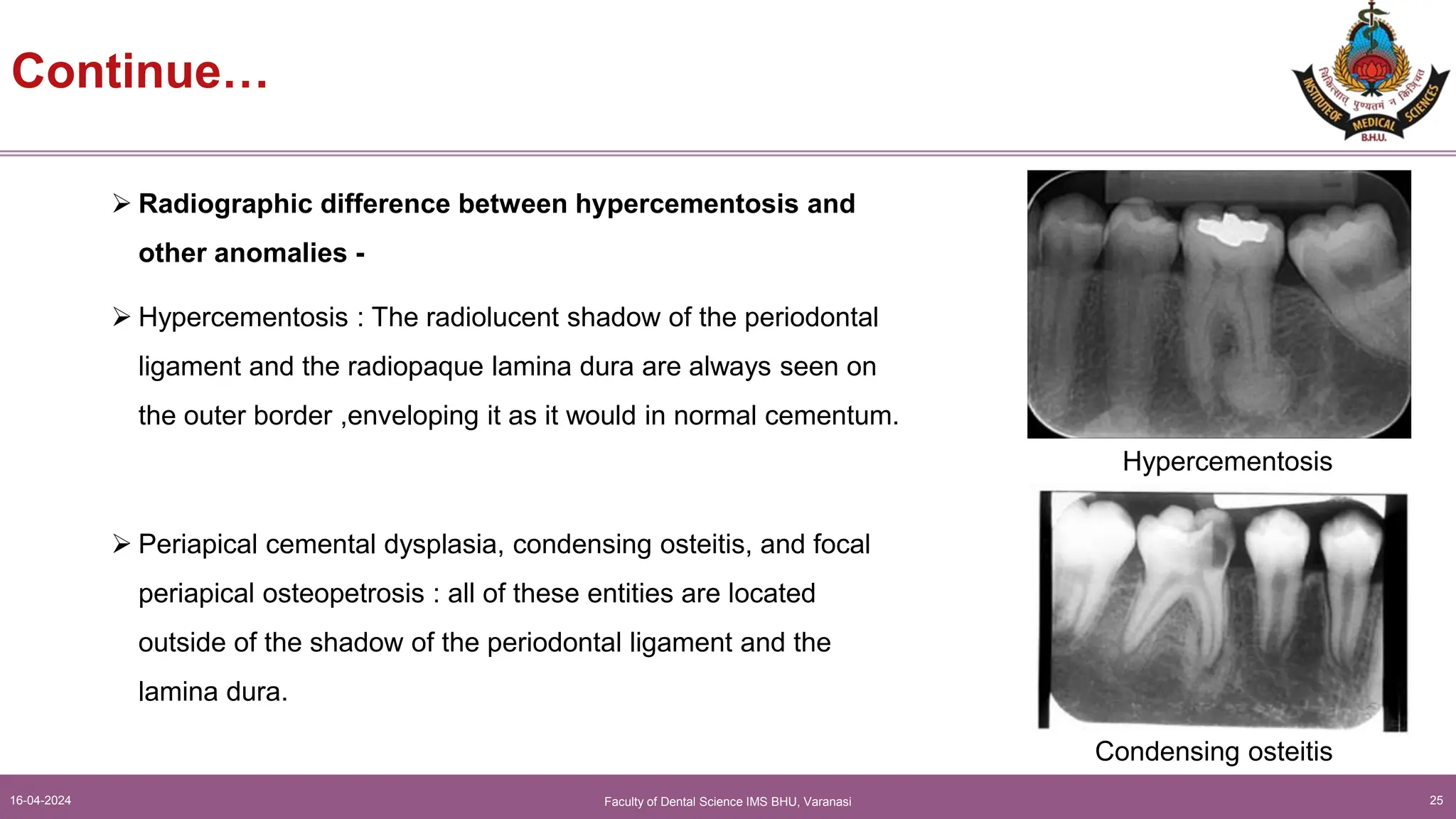 Cementum_Dhanraj_meena-17 09 23 (1).pptx