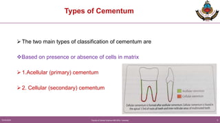 Cementum_Dhanraj_meena-17 09 23 (1).pptx