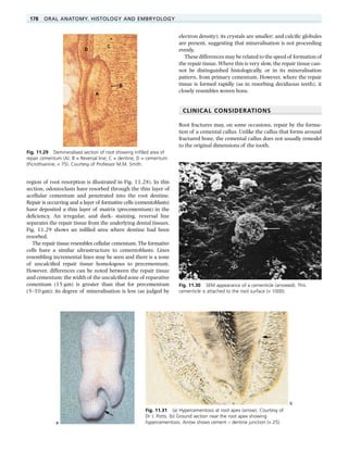 Cementum elsevier | PDF