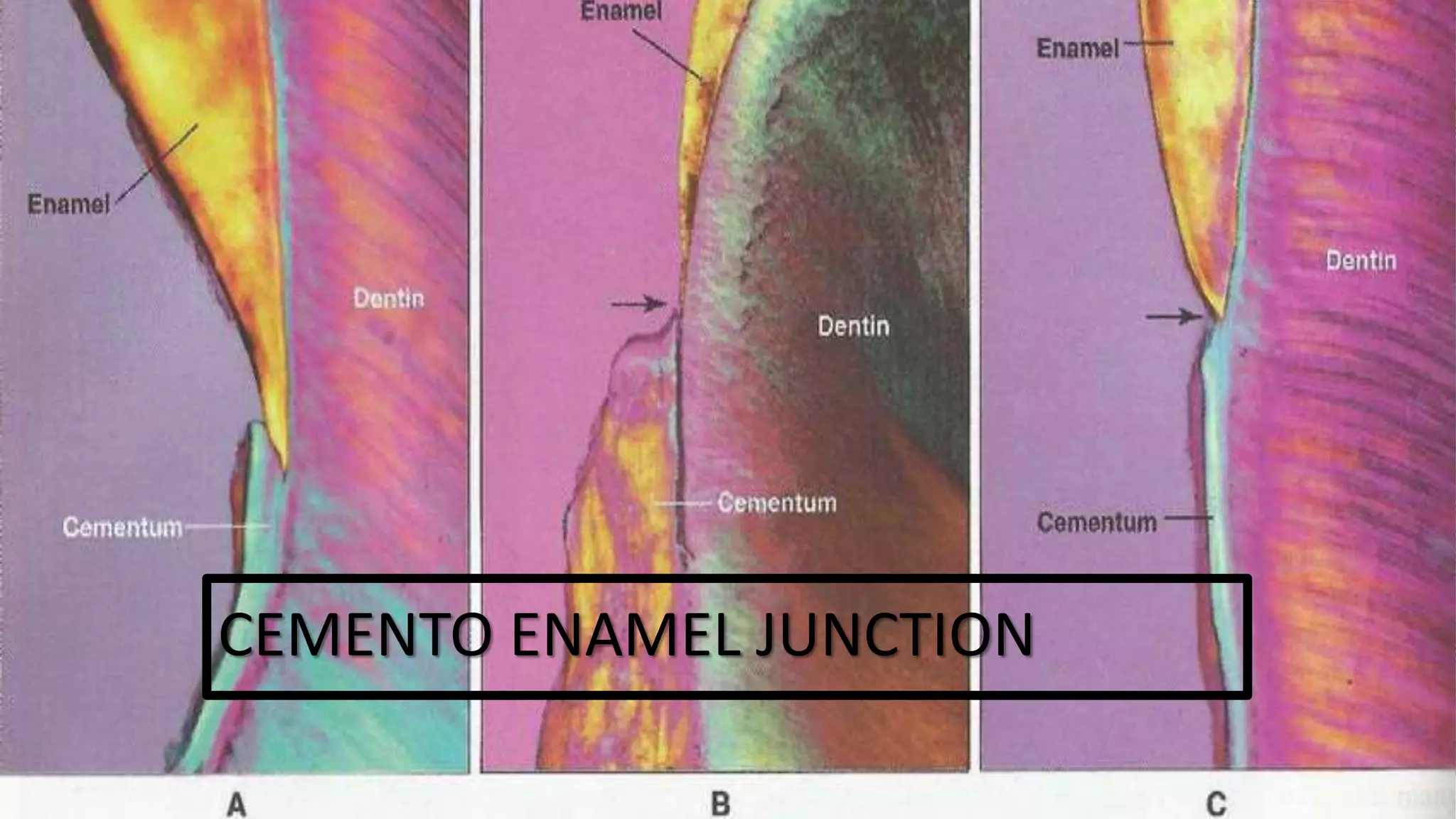 CEMENTUM .pptx