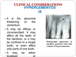 Cementum | PPTX