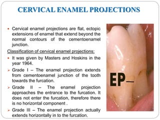 Cervical Enamel Projection