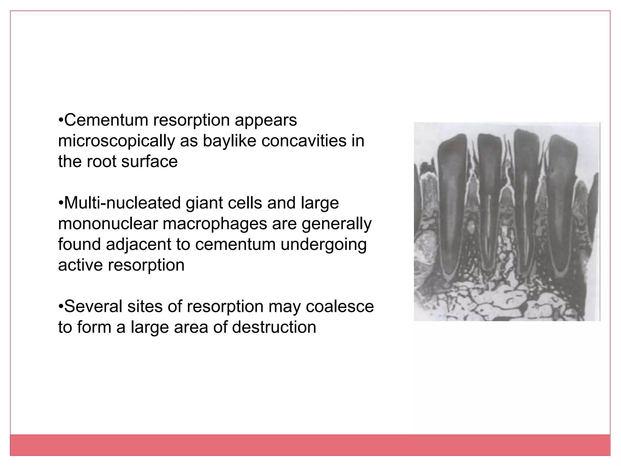 Cementum | PPTX