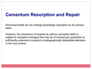 Cementum | PPTX