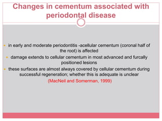 Cementum | PPTX
