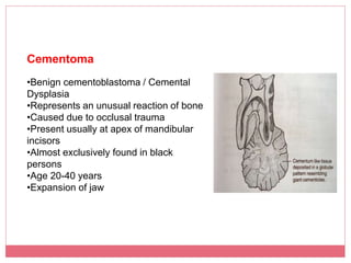 Cementum | PPTX