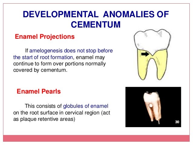 Cementum