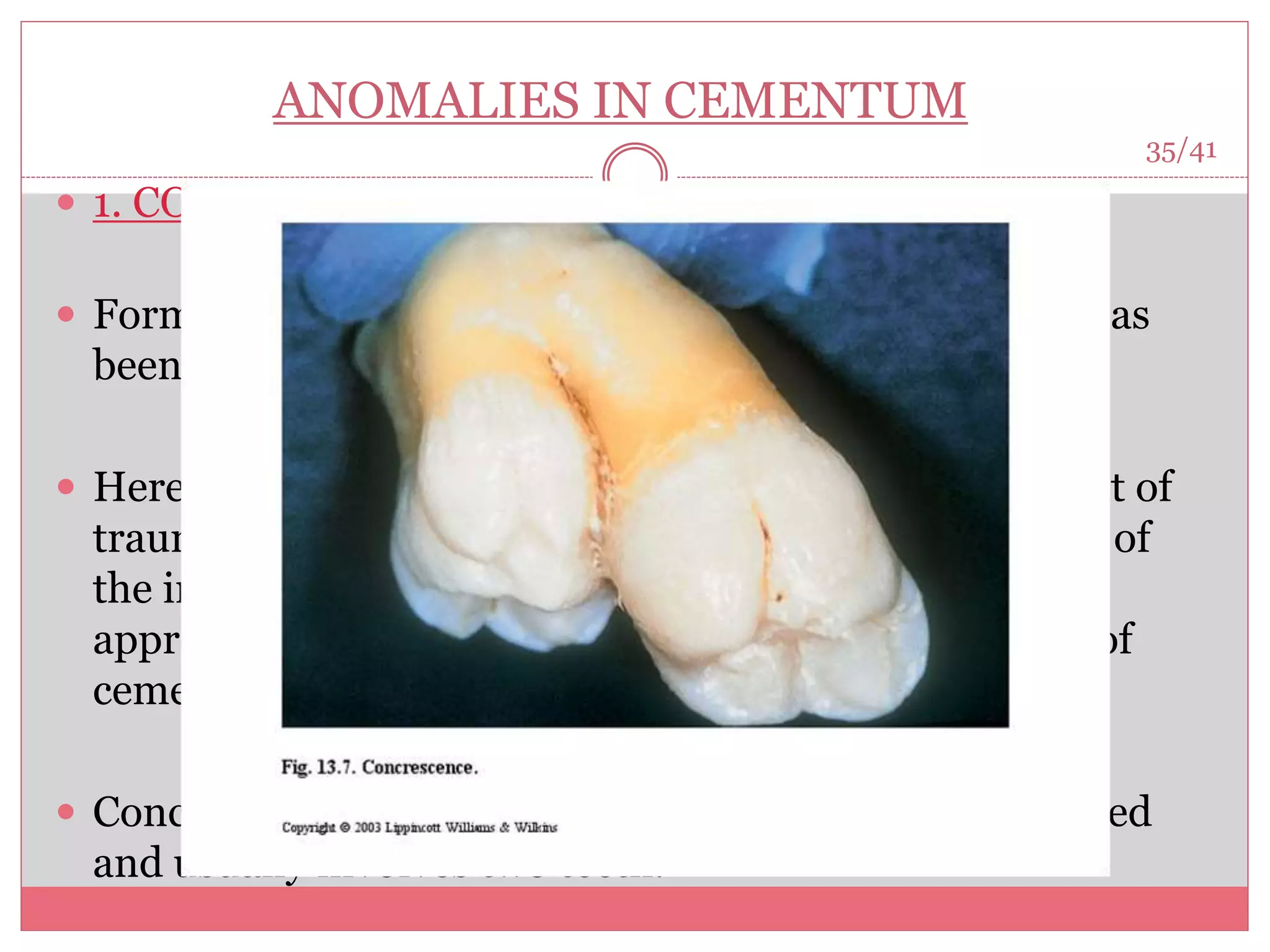 Cementum in health and disease | PPTX