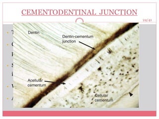 Cementum in health and disease | PPTX