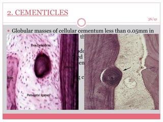 Cementum in health and disease | PPTX