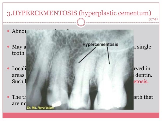 Cementum in health and disease