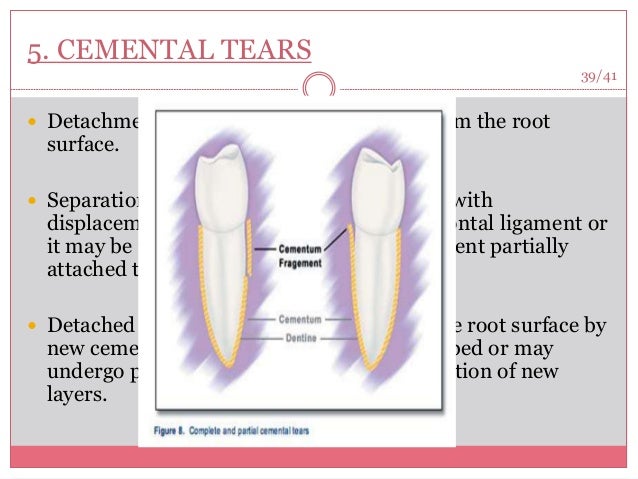 Cementum in health and disease