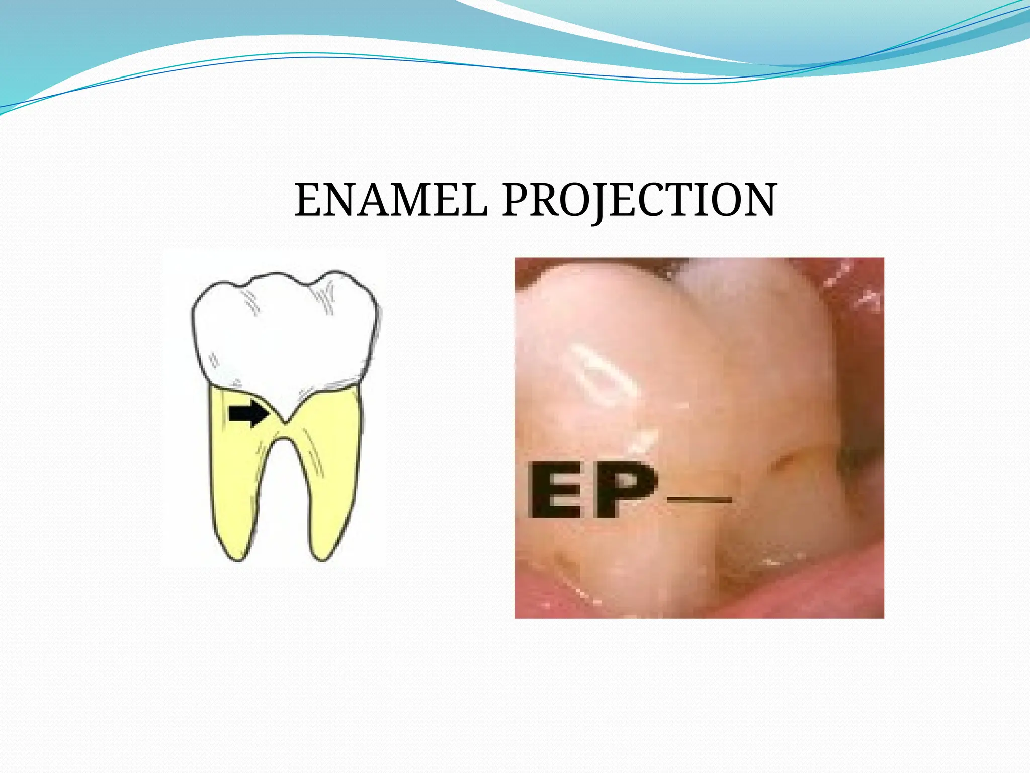 cementum in health and disease.pptx periodontology | PPTX