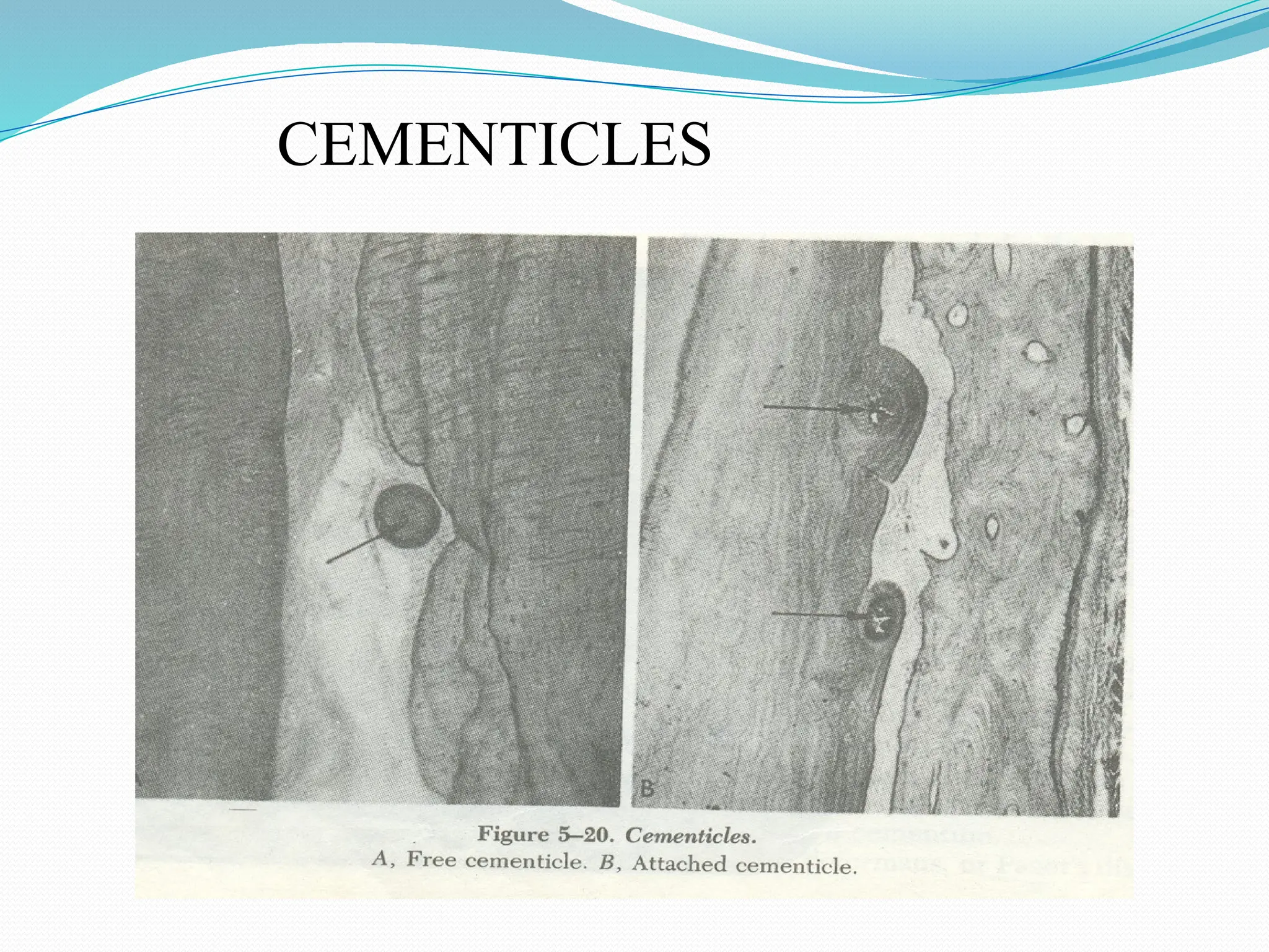 cementum in health and disease.pptx periodontology | PPTX