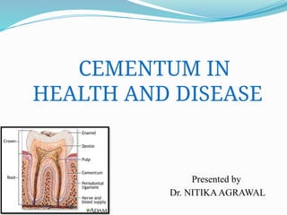 cementum in health and disease.pptx periodontology | PPTX