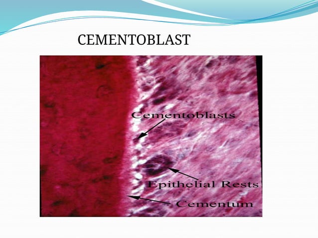 cementum in health and disease.pptx periodontology | PPTX
