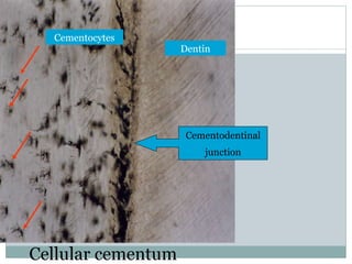 Cementum and Cementogenesis Lecture.pptx